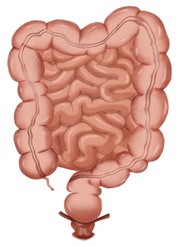 Surgery Excel - Παθήσεις του Εντέρου